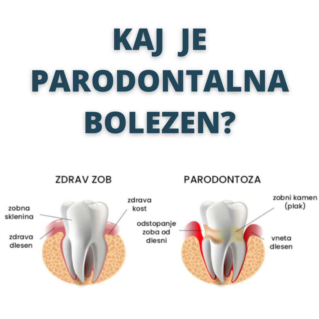 Kako se obvarovati? Bolezen, ki prizadene polovico svetovnega ...