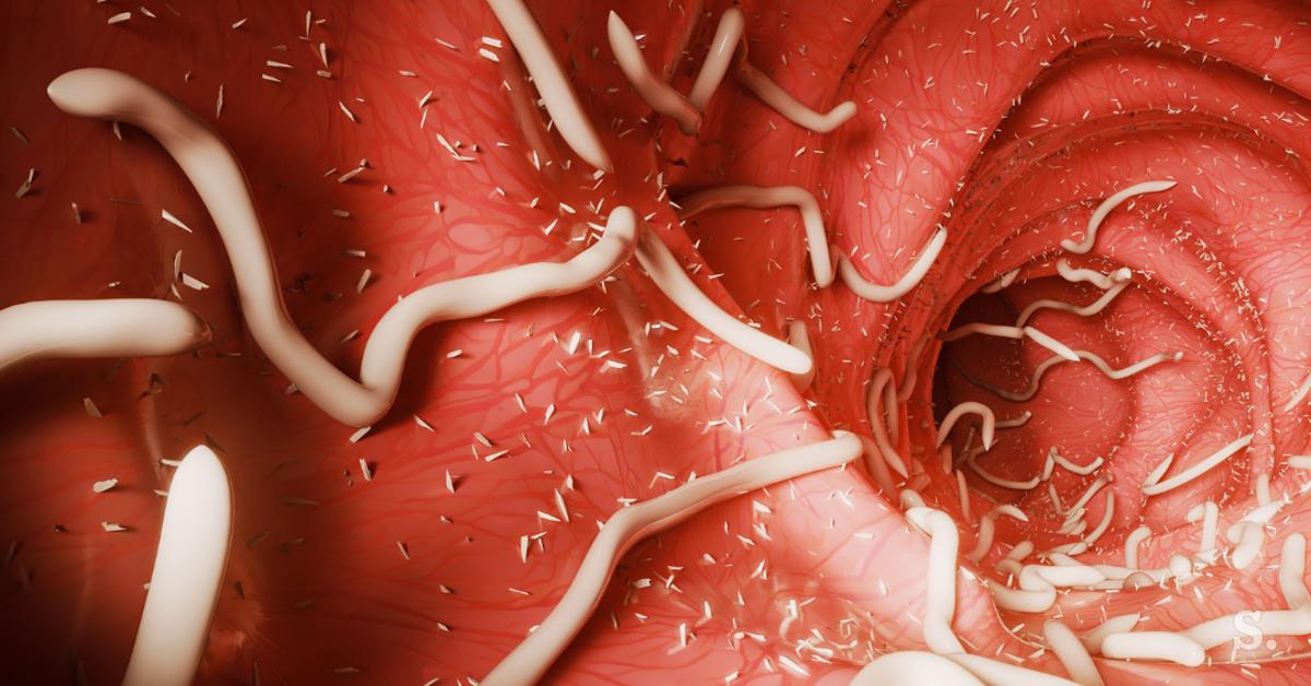 Huda invazija glist podančic v slovenskih šolah in vrtcih - siol.net